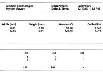 Standard inclusion rating - Clemex