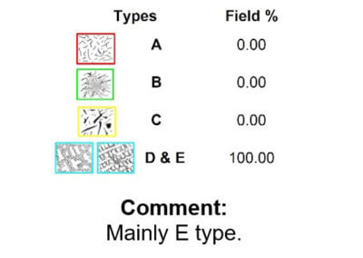 Flake size as per ASTM A247 and ISO 945 - Clemex