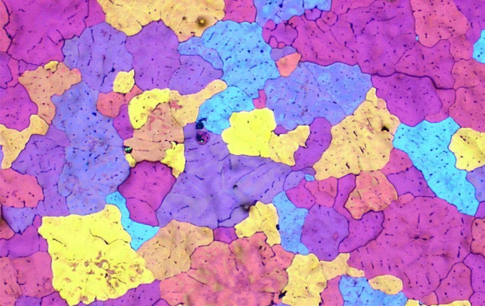 Automated Image Analysis System | Solutions | Microscopy