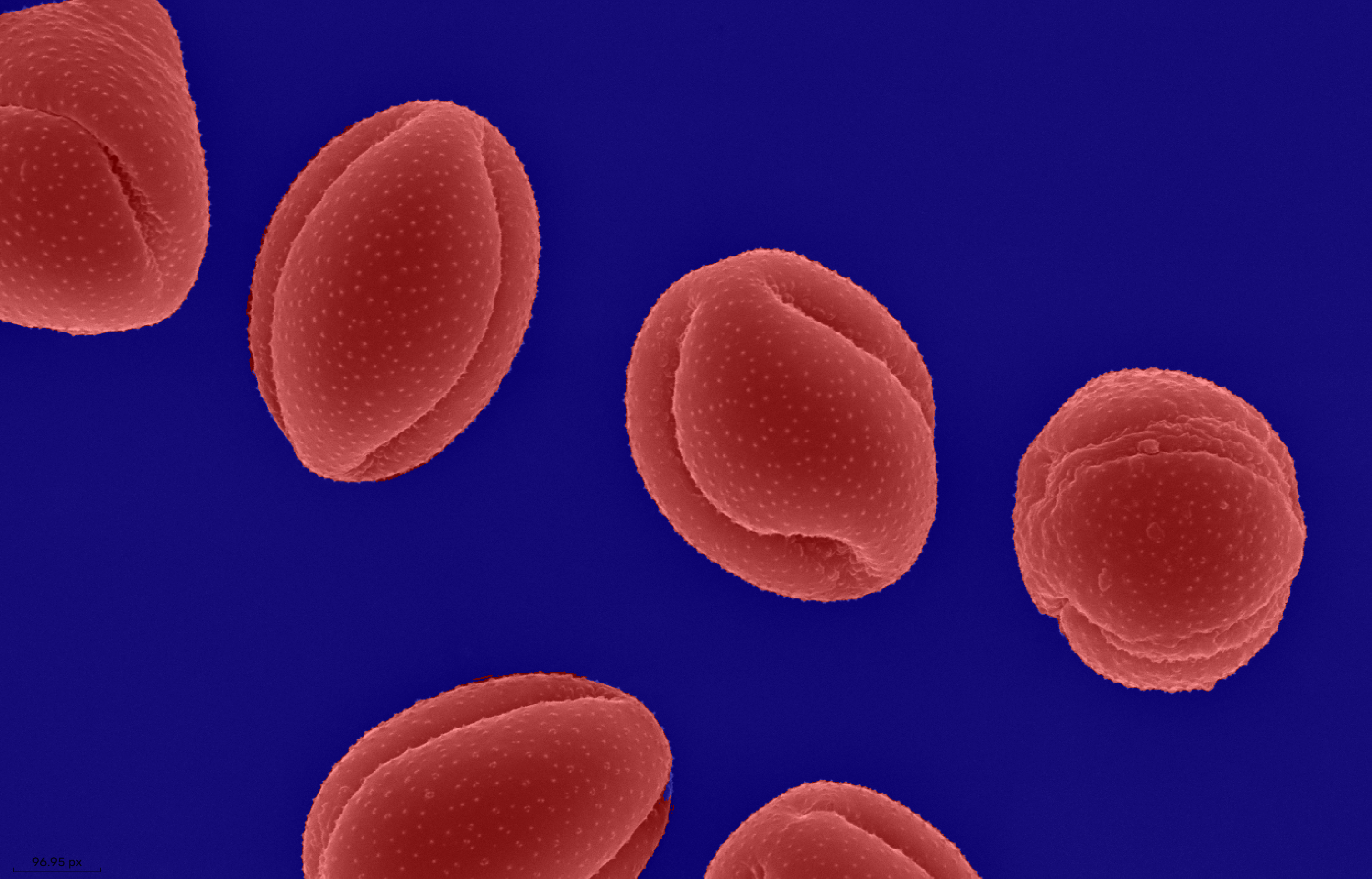 Automated Image Analysis System | Solutions | Microscopy