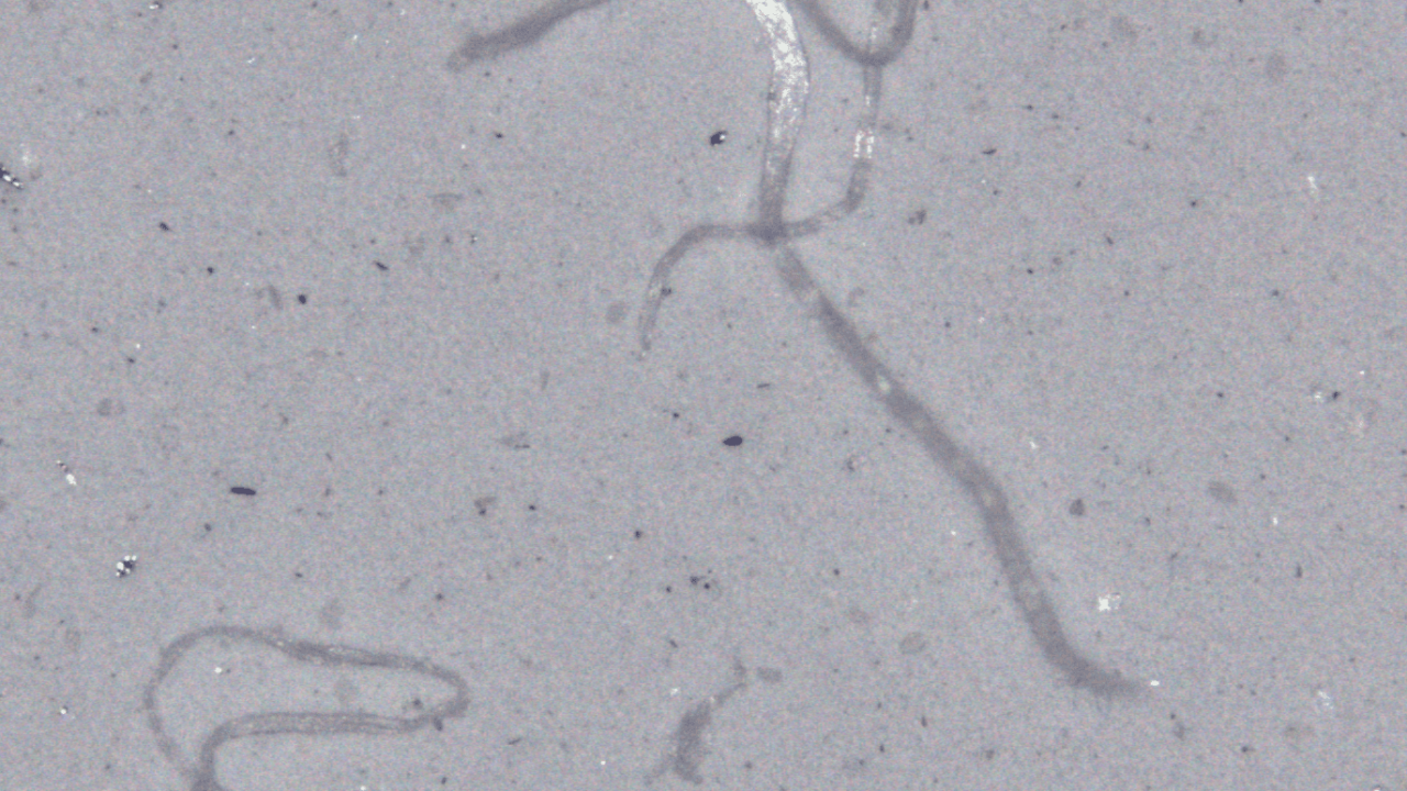 Automated Image Analysis System | Solutions | Microscopy