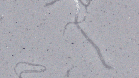 Automated Image Analysis System | Solutions | Microscopy